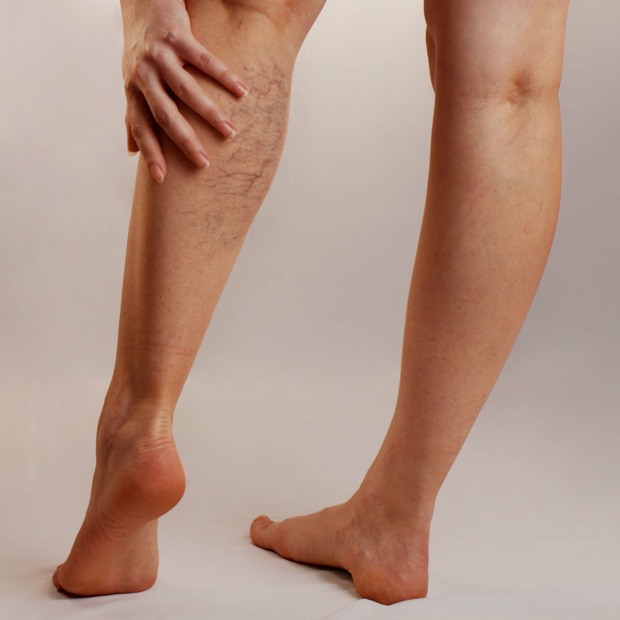 Varico Gel - Self Matters